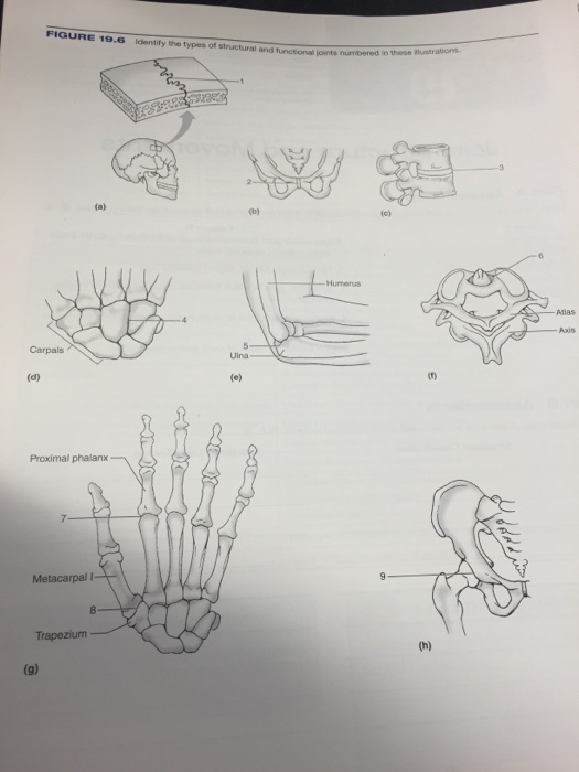 Solved Identify The Types Of Structural And Functional