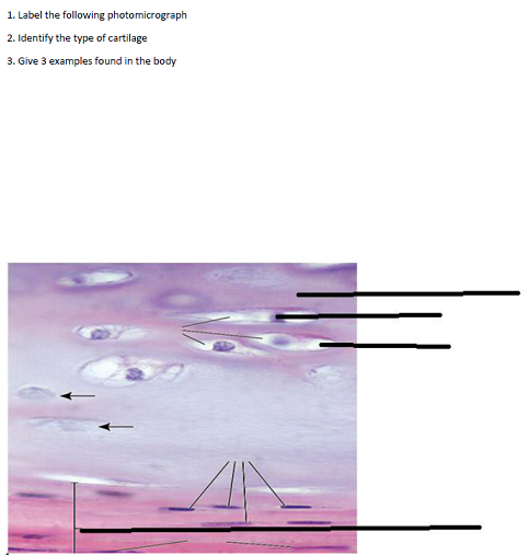 Solved Label the following photomicrograph Identify the | Chegg.com