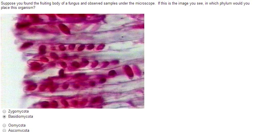 Solved Suppose you found the fruiting body of a fungus and | Chegg.com
