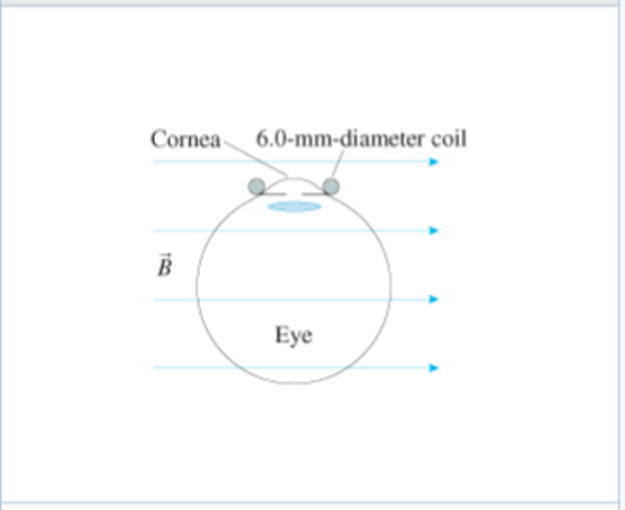 A Cyberphysics Page Medical Physics Questions On The Eye