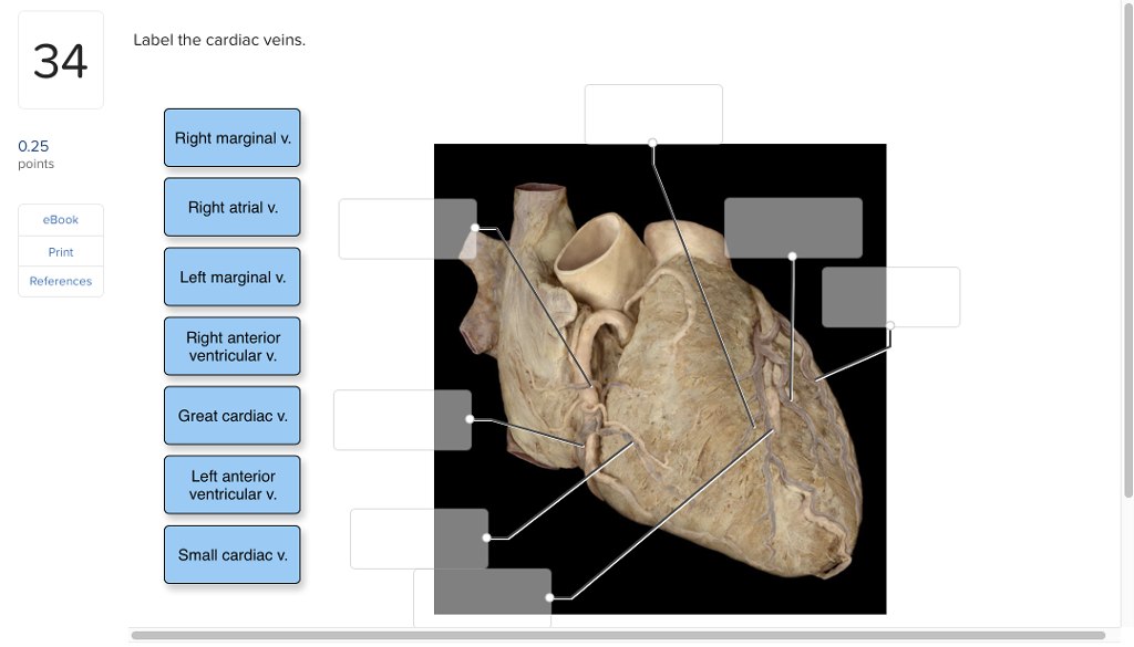 Solved Label the cardiac veins. 34 Right marginal v. 0.25 | Chegg.com