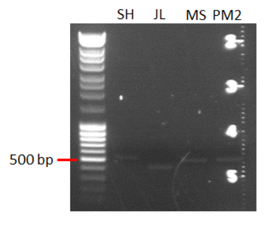 Solved Use the gel and MassRuler DNA ladder mix chart | Chegg.com