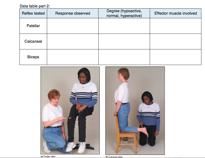 Solved Data table part 2 Degree (hypoactive, normal, | Chegg.com