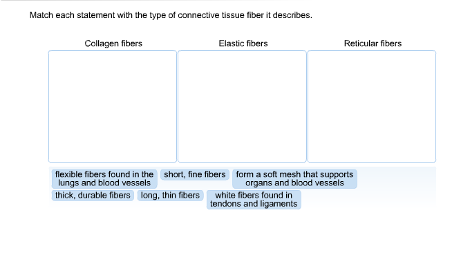 Solved Match each statement with the type of connective | Chegg.com