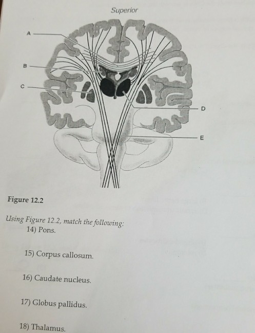 Solved Superior Figure 12.2 Using Figure 12.2, match the | Chegg.com