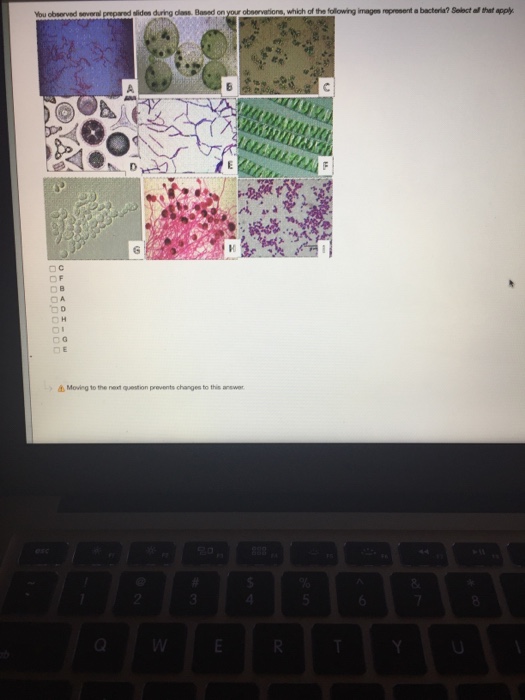 Solved You observed several prepared slides during class. | Chegg.com
