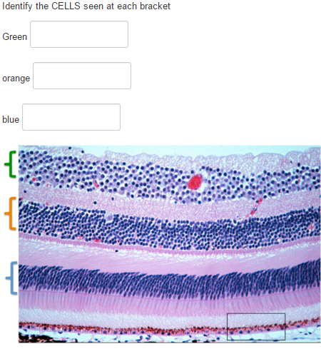 Solved Identify the CELLS seen at each bracket Green orange | Chegg.com