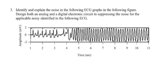 Solved Identify and explain the noise in the following ECG | Chegg.com