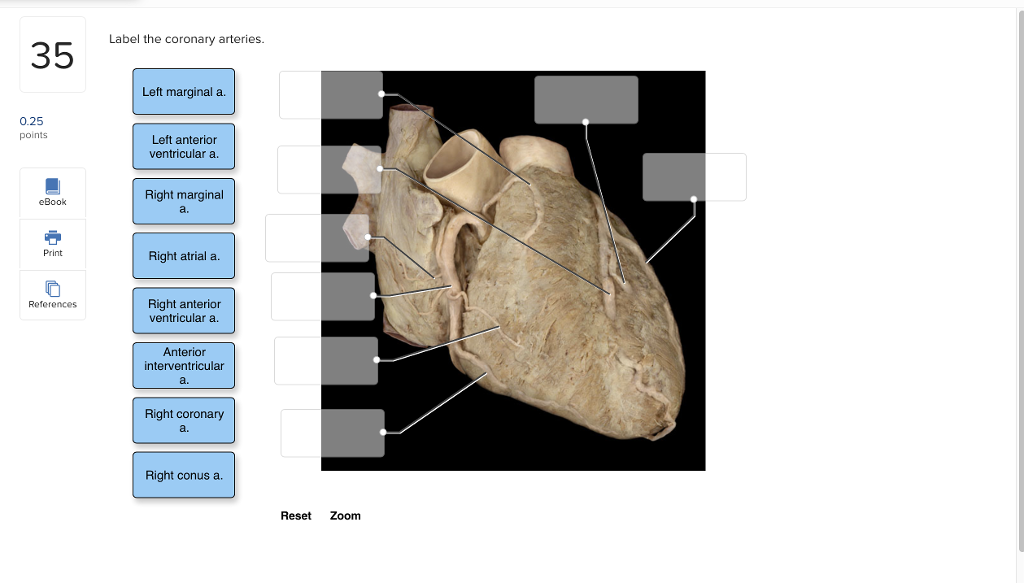 Solved Label the coronary arteries. Left marginal a. 0.25 | Chegg.com