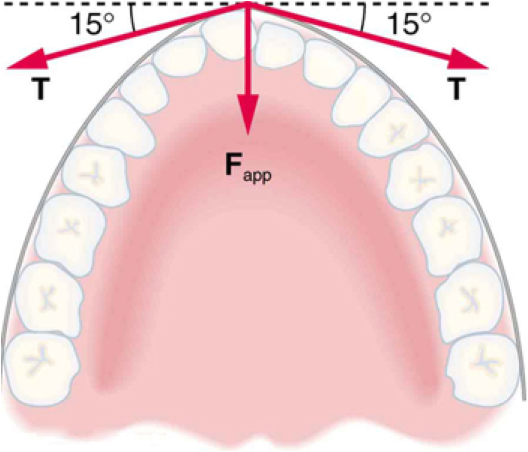 Solved What force is exerted on the tooth in Figure 8 | Chegg.com