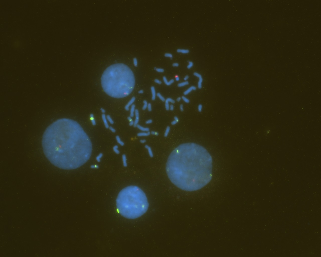 Solved FISH analysis of centromere associated human | Chegg.com