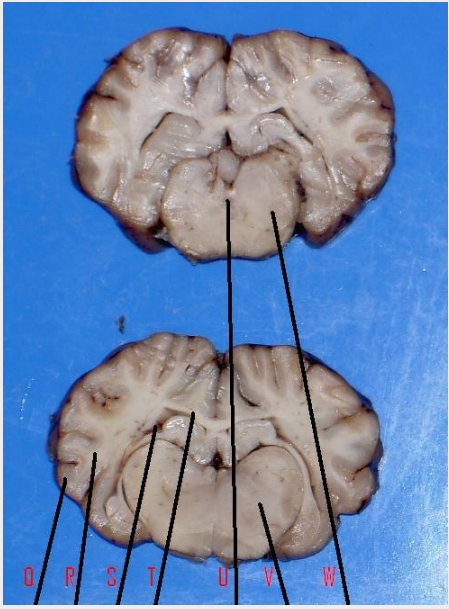 Corpora Quadrigemina