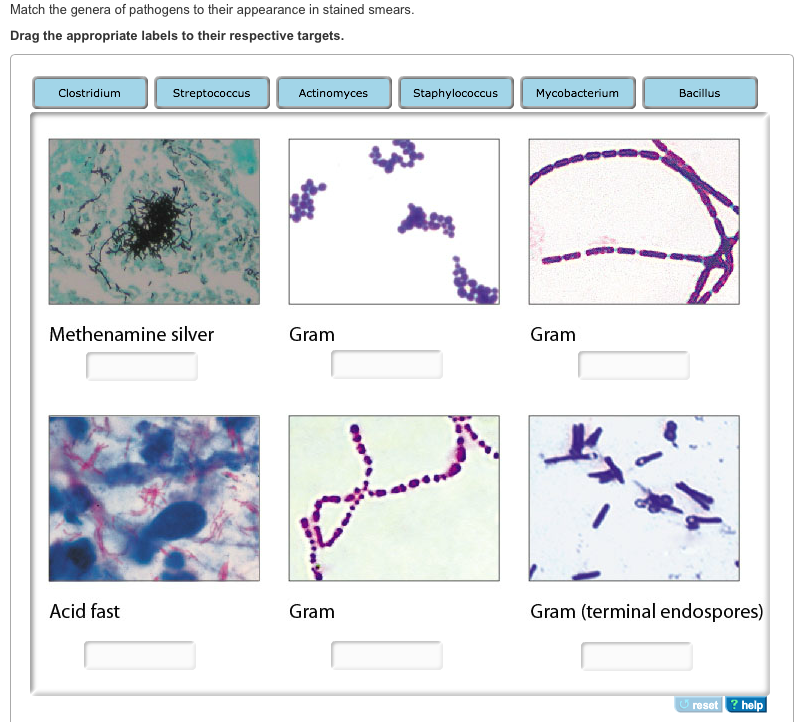 Solved Match the genera of pathogens to their appearance in | Chegg.com