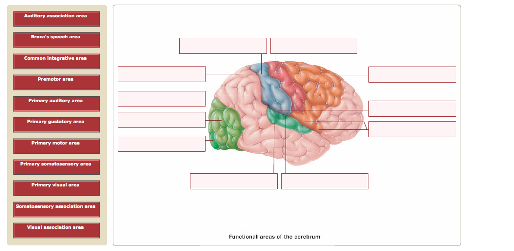 Solved Auditory association area Broca's speech area Common | Chegg.com