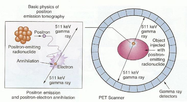 Solved Here's how the problem works: In a PET system, we | Chegg.com
