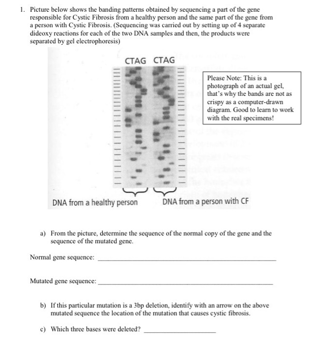 Solved Picture below shows the banding patterns obtained by | Chegg.com