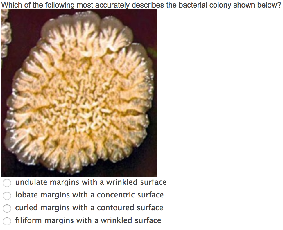 Solved Which of the following most accurately describes the | Chegg.com