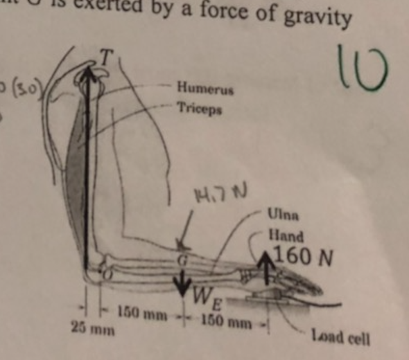 Solved (10 pts] In a medical procedure, the load cell pushes | Chegg.com