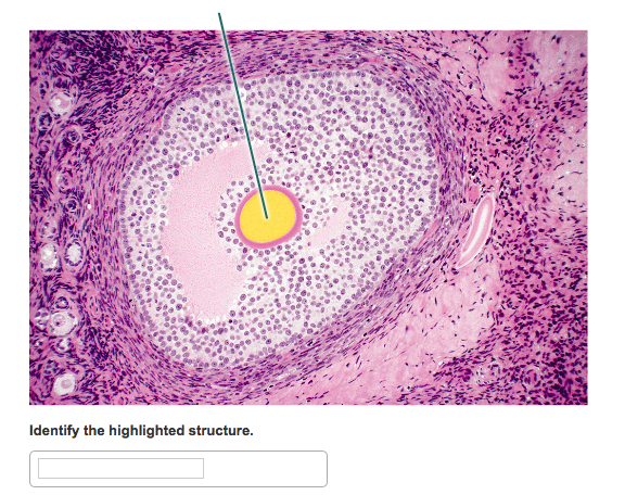 Solved Identify the highlighted structure. | Chegg.com
