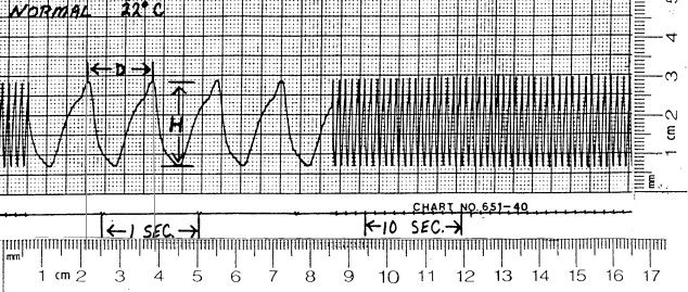 Solved Sample calculation below: To calculate the | Chegg.com