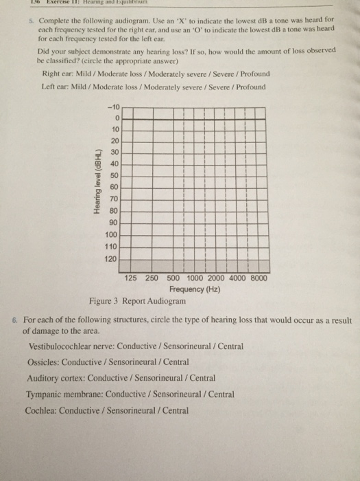 Solved Complete the following audiogram. Use an 'X' to | Chegg.com