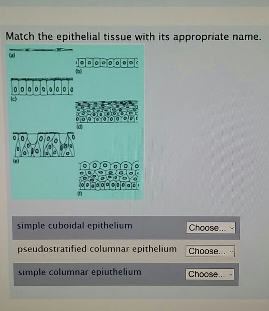Solved Match the epithelial tissue with its appropriate | Chegg.com