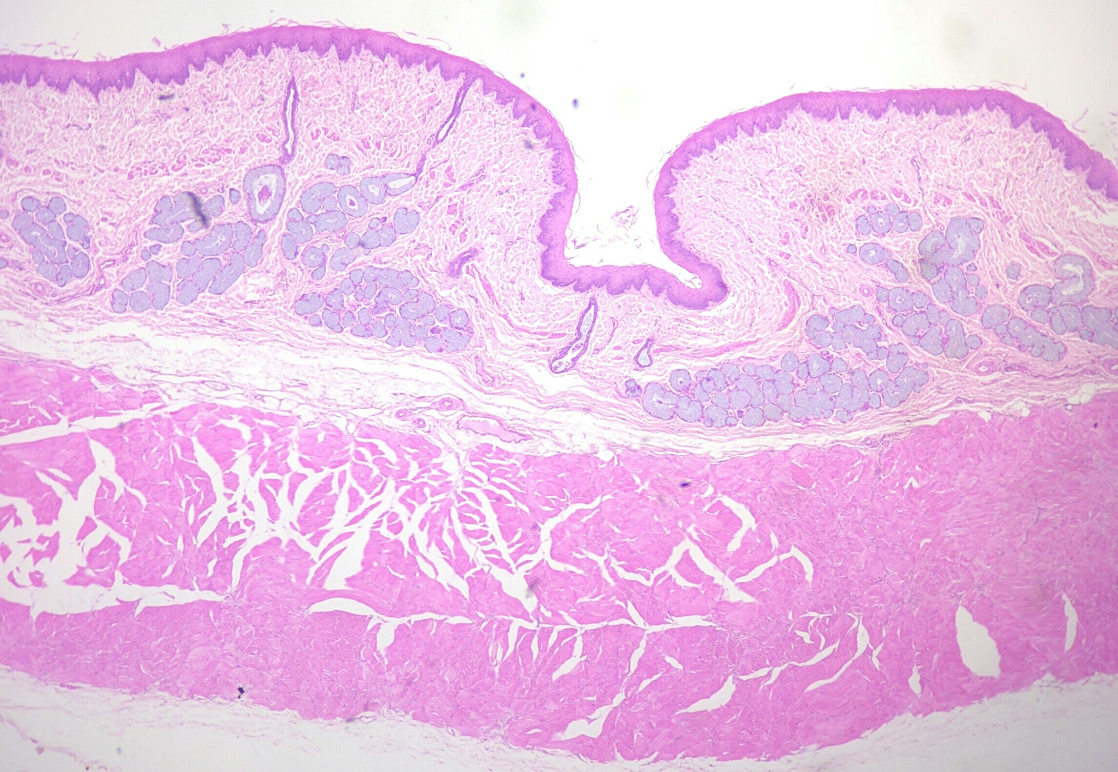 Solved Can someone help me label an esophagus slide? I need | Chegg.com Solved Can someone help me label an esophagus slide? I need | Chegg.com