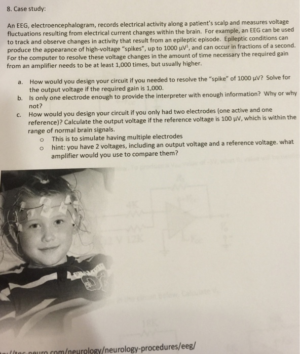 Solved Case study: An EEG, electroencephalogram, records | Chegg.com