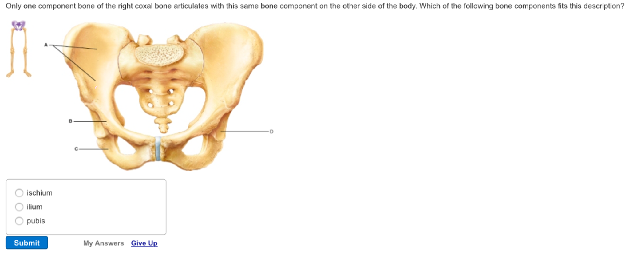 Solved Only one component bone of the right coxal bone | Chegg.com