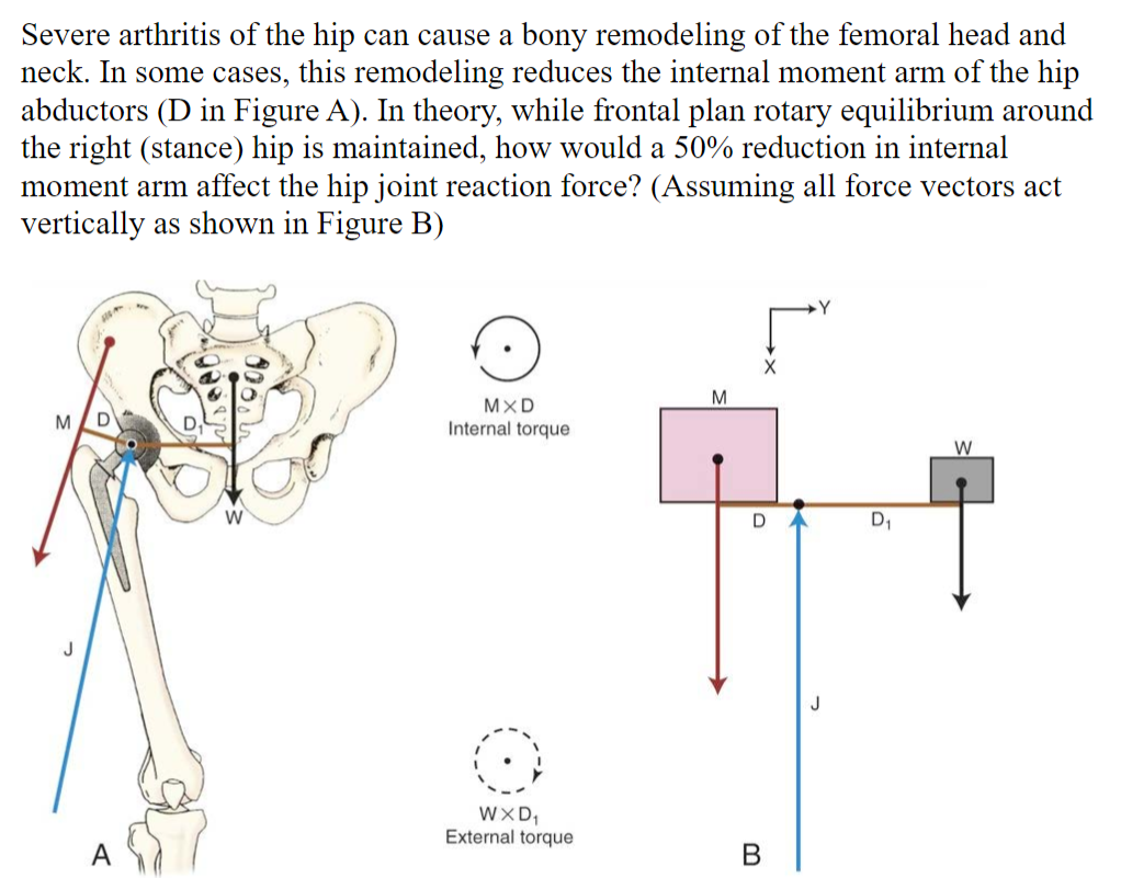 Solved Severe arthritis of the hip can cause a bony | Chegg.com