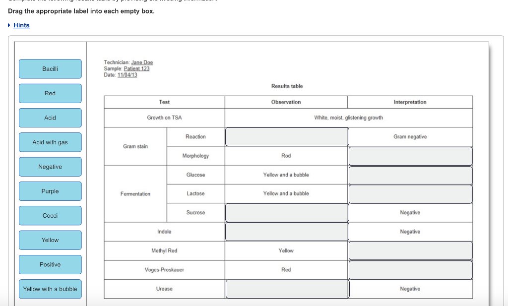 Solved Andy performed an Ornithine Decarboxylase test on his | Chegg.com
