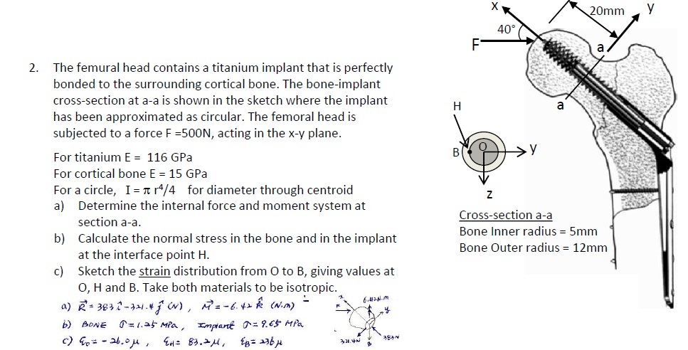 The femural head contains a titanium implant that is | Chegg.com