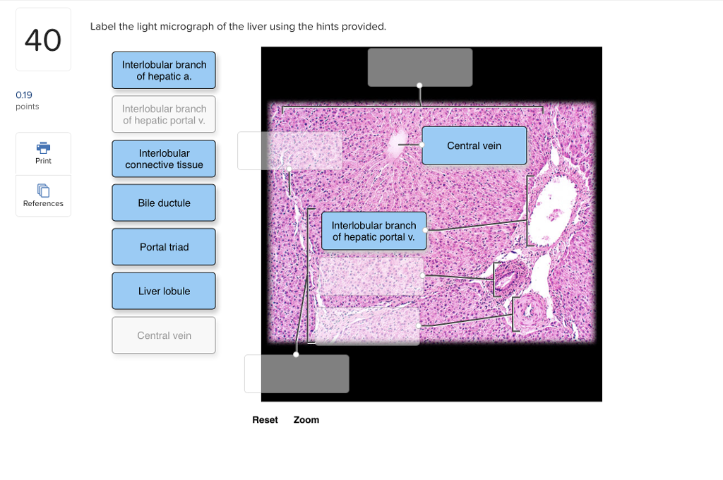 Solved Label the light micrograph of the liver using the | Chegg.com