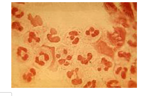 Solved Below is a view at 1000X magnification of a Gram | Chegg.com