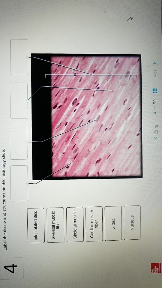 Solved Label the tissue and structures on this histology | Chegg.com