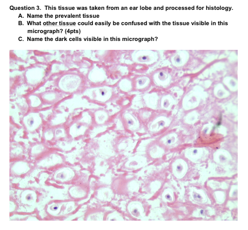 Solved This tissue was taken from an ear lobe and processed | Chegg.com