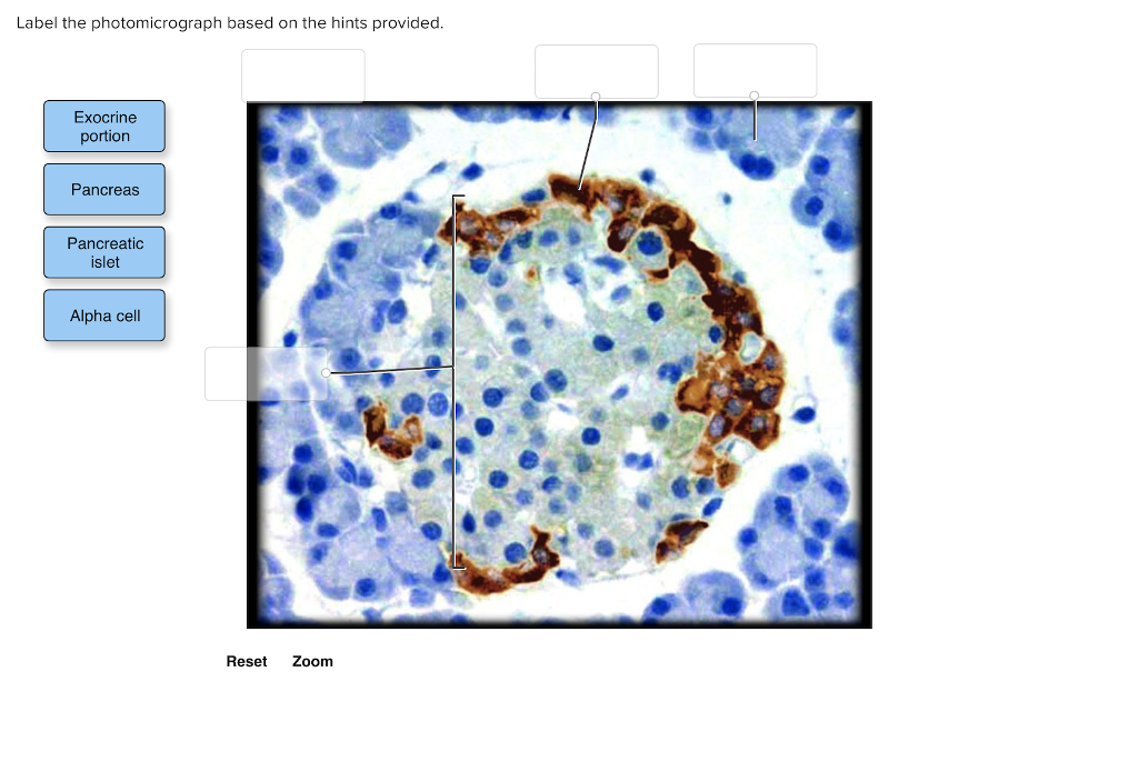 Solved Label the photomicrograph based on the hints provided | Chegg.com