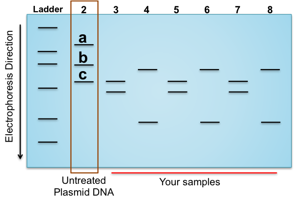 Solved When gel-running a plasmid DNA uncut by any enzyme, | Chegg.com