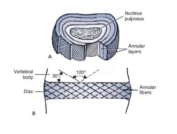 Annular fibers in Intervertebral Discs has 30 degree | Chegg.com