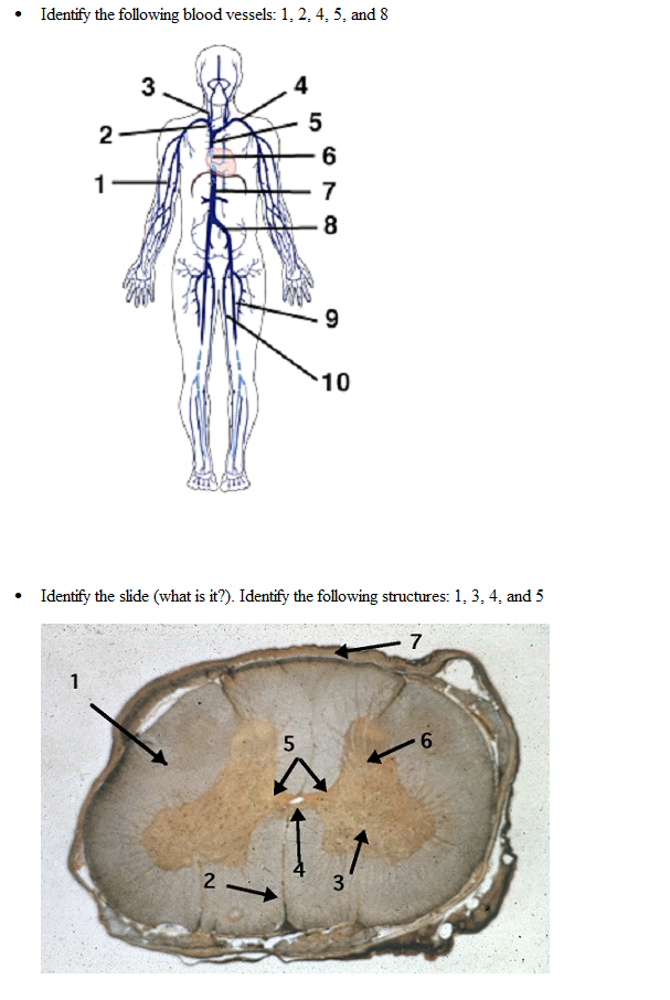 Solved Blood Vessels and Nervous System) Identify the | Chegg.com
