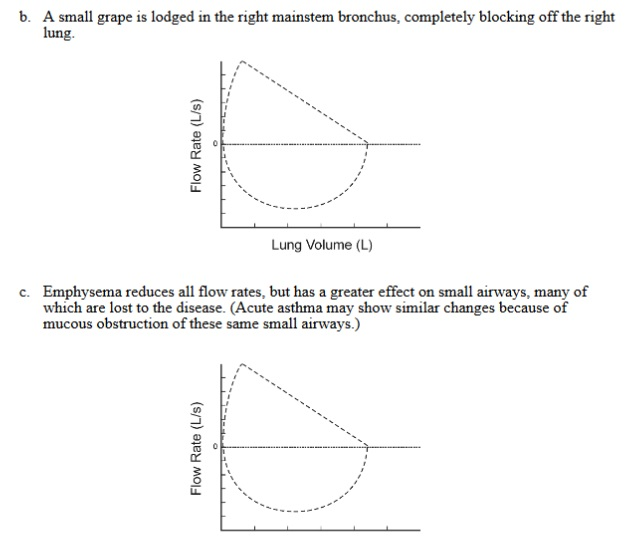 Solved 1. Using the flow volume loops pictured below as | Chegg.com
