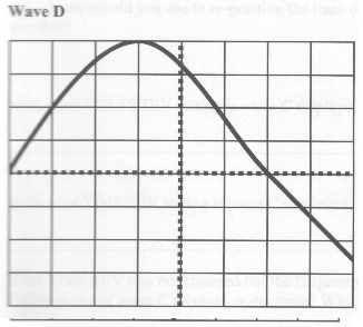 Solved (1)The Volts/div setting is .5 volts/division and the | Chegg.com