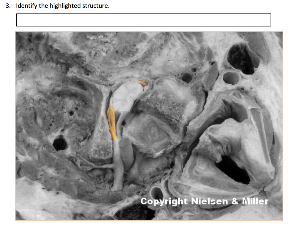 Solved 8. Identify the highlighted structure. Copyright | Chegg.com