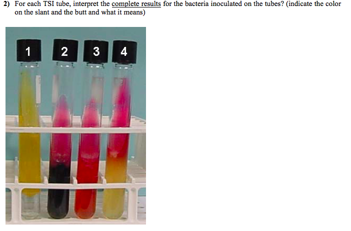 Solved 2) For each TSI tube, interpret the complete results | Chegg.com