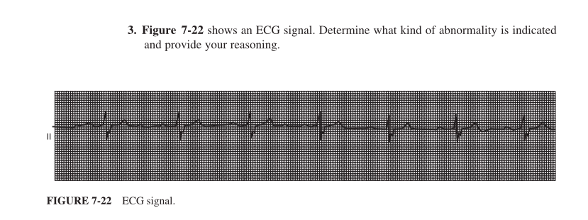 Solved Figure 7-22 shows an ECG signal. Determine what kind | Chegg.com