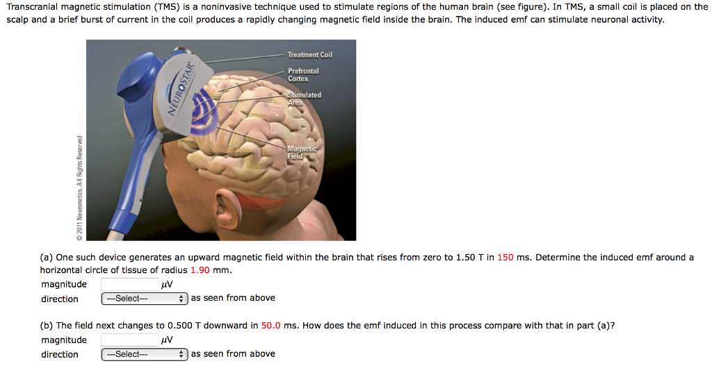 Solved Transcranial magnetic stimulation (TMS) is a | Chegg.com