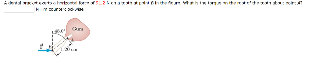 Solved A dental bracket exerts a horizontal force of 91.2 N | Chegg.com