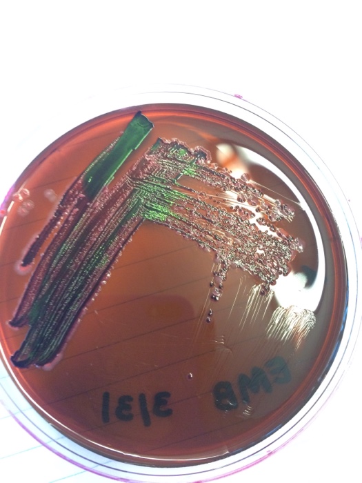 Solved Microbiology EMB question.I did a streak plate on an | Chegg.com