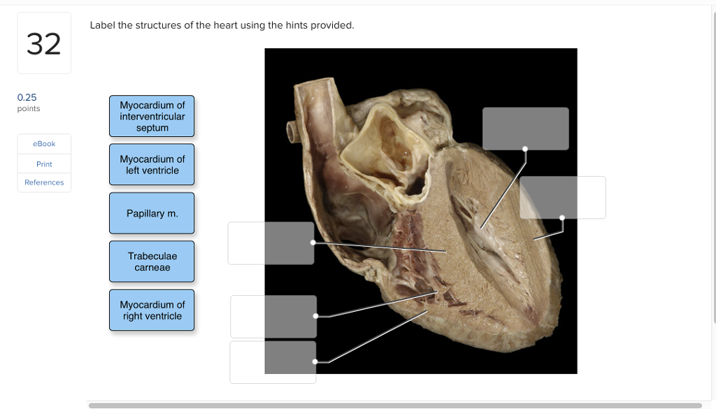 Solved Label The Structures Of The Heart Using The Hints