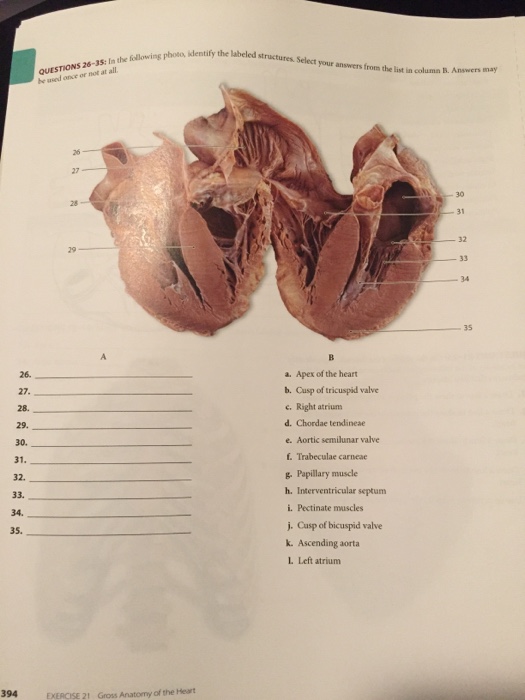 Solved In the following photo, identify the labeled | Chegg.com
